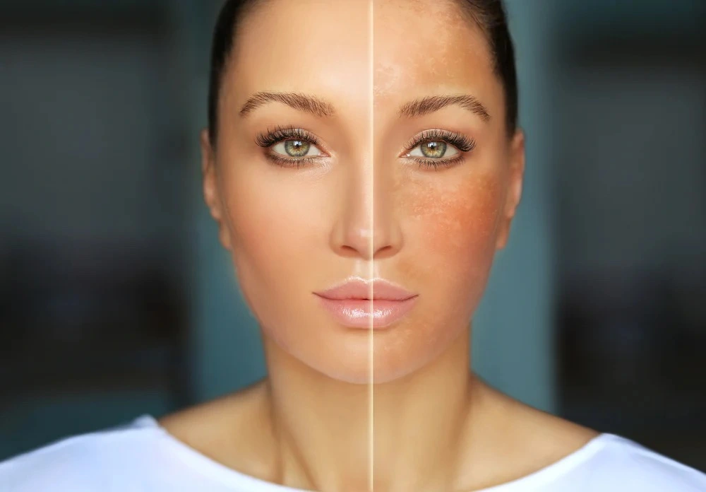 Secrets of Spring Skincare for Mature Skin in Vancouver